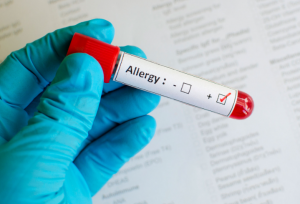 Allergy - Lancet Laboratory