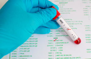 HIV & AIDS - Lancet Laboratory