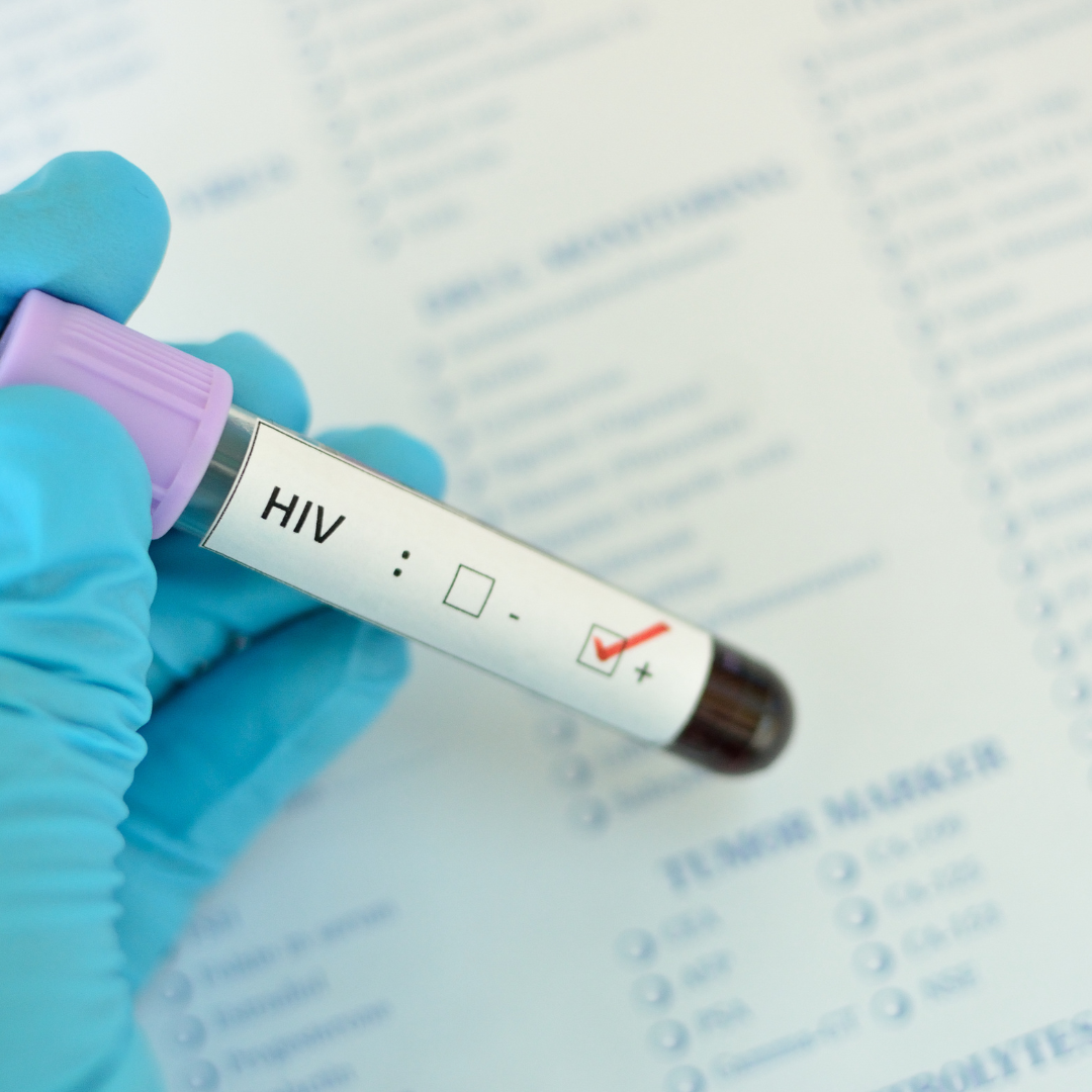HIV & AIDS - Lancet Laboratory