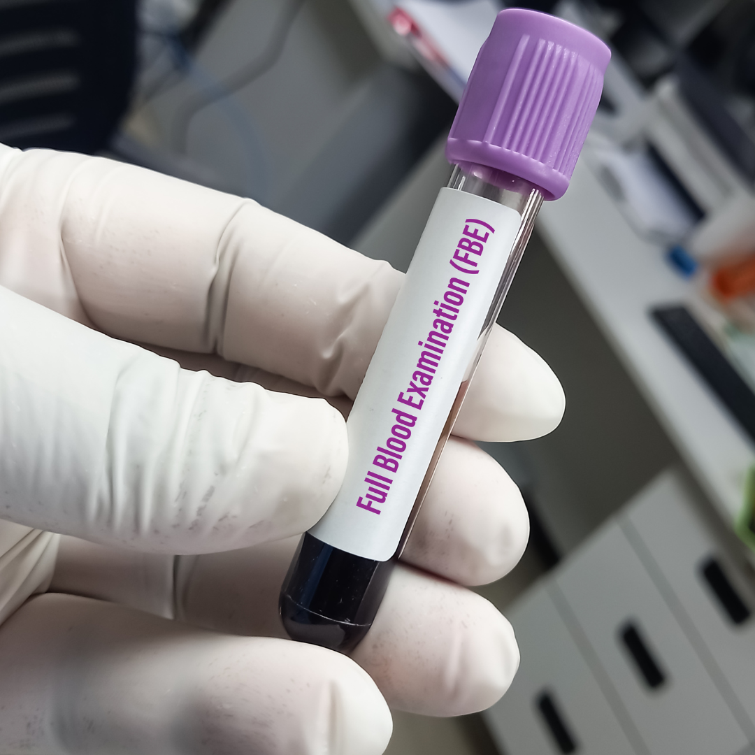 Health Screening for Men & Women - Lancet Laboratory